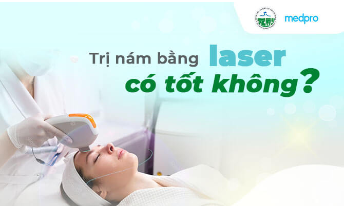 Bắn laser trị nám có hiệu quả không? Chi phí hết bao nhiêu?