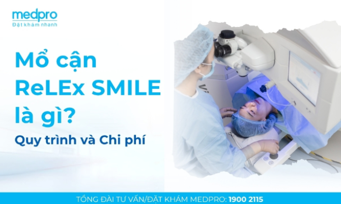 Mổ cận ReLEx SMILE là gì? Quy trình và Chi phí 2026